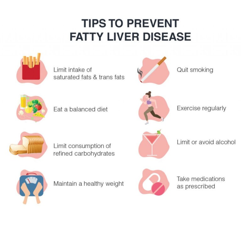 Non-Alcoholic Fatty Liver Disease: Management With Exercise – McIsaac ...